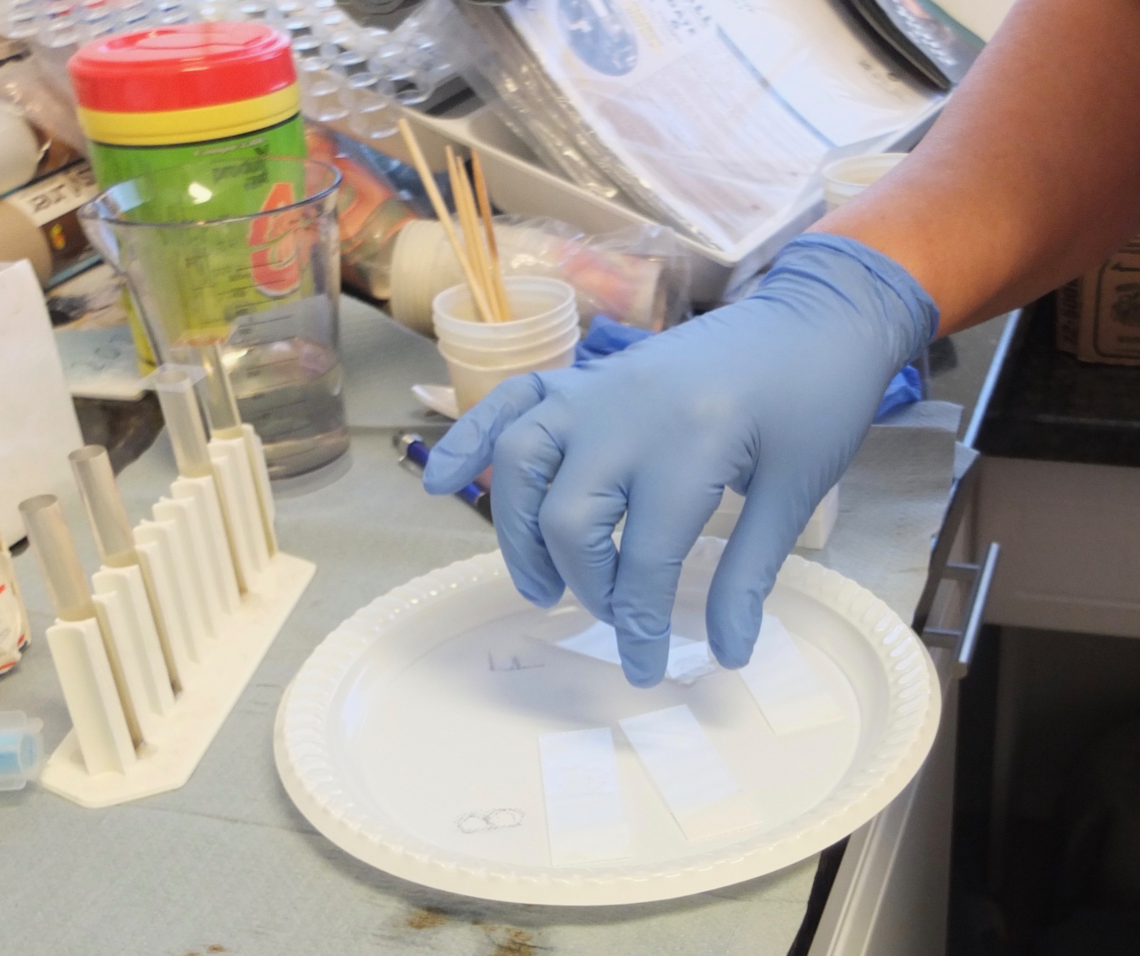 Fecal Float Testing: On The Hunt For Chicken Parasites – Bitchin' Chickens