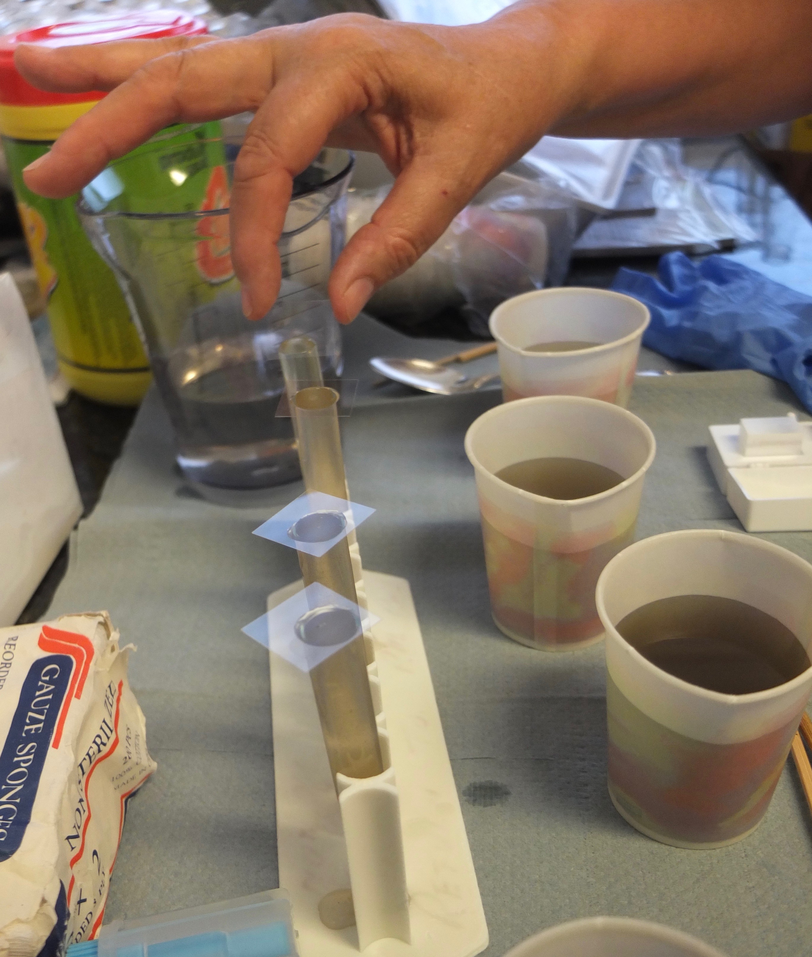 Fecal Float Testing: On The Hunt For Chicken Parasites – Bitchin' Chickens