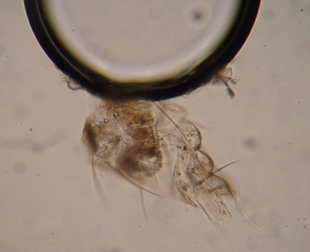 Fecal Float Testing: On The Hunt For Chicken Parasites 2 – Bitchin ...